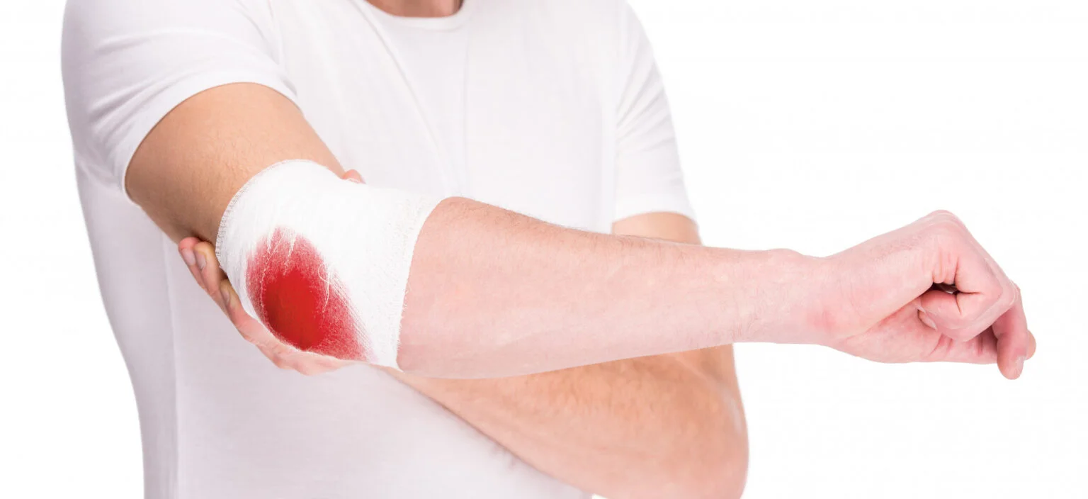 Average Settlement for Soft Tissue Injuries in Car Accidents